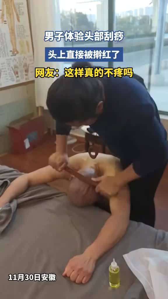 男子体验头部刮痧,头上直接被擀红了,网友:这样真的不疼吗