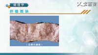 第七章 心血管系统疾病 第一节 动脉粥样硬化 2.动脉粥样硬化的基本...