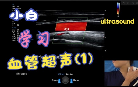 超声小白教程-颈部血管扫查