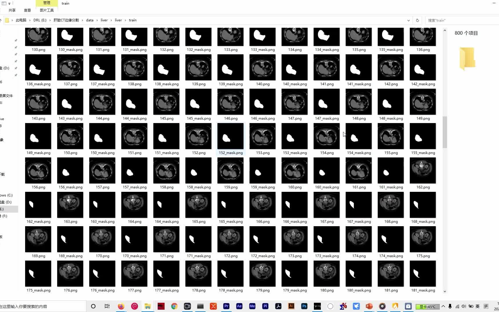 pytorch深度学习教程--肝脏CT分割数据集