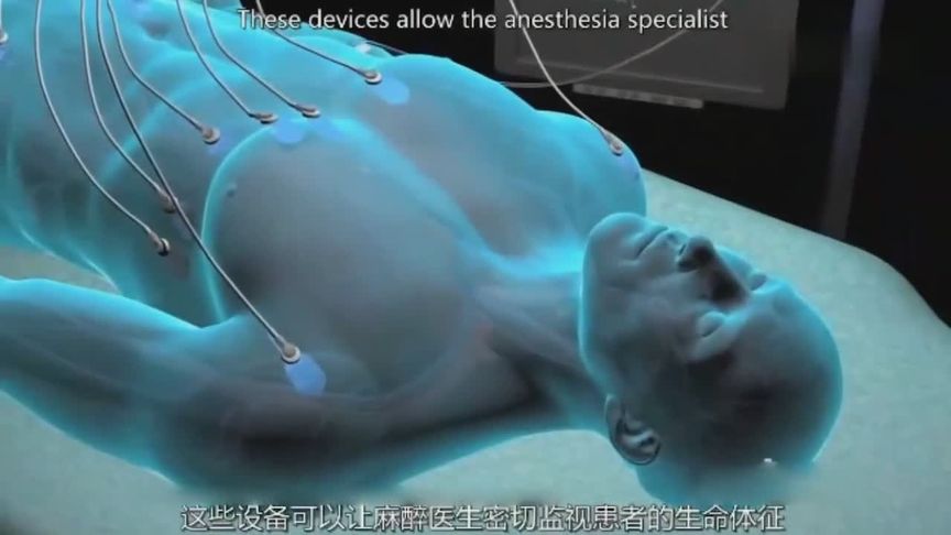 3D动画演示全身麻醉手术全过程,看上去没有你想象的恐怖!