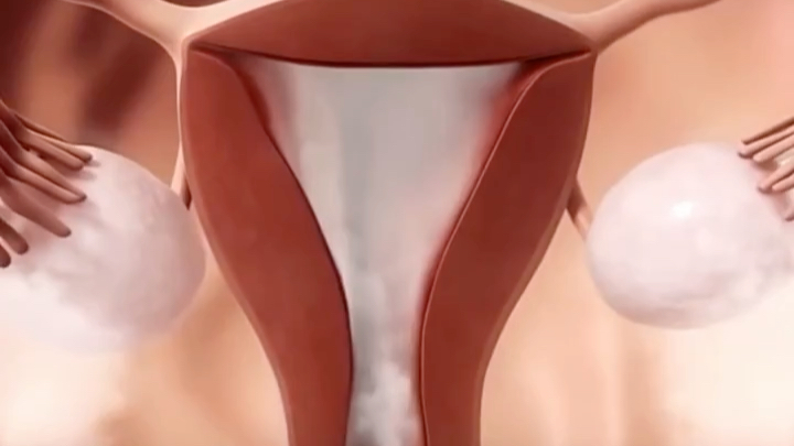 输卵管造影3D动画,堵没堵一目了然!