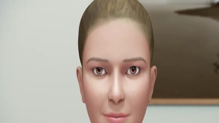 隆的鼻子真一捏就扁?3D动画演示隆鼻手术全过程,看完你就知道了