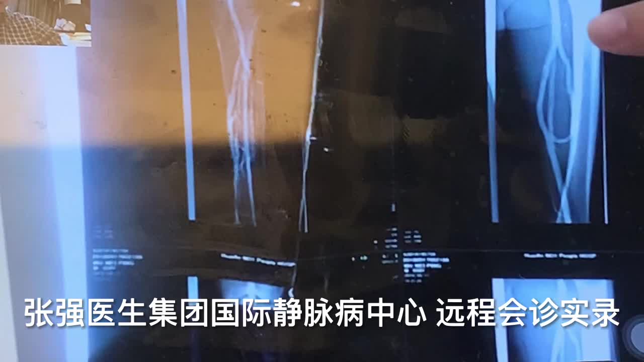 远程会诊,有时能解决大问题。