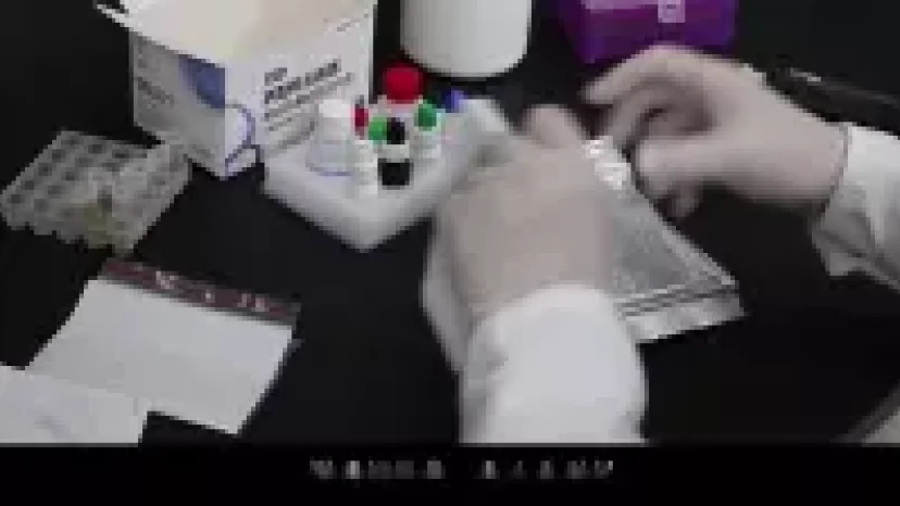 丙型肝炎病毒核心抗原检测试剂盒(酶联免疫法)