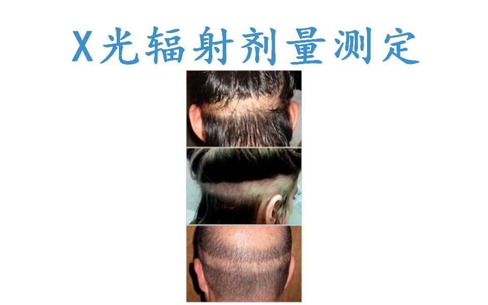 【医学成像100】66. CT辐射剂量测量*美国医学物理师*西安电子科技...