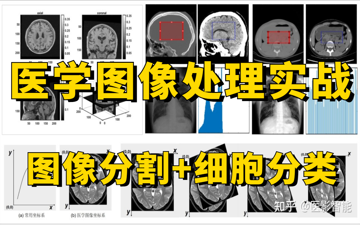 医学图像处理实战:基于U-Net的图像分割+基于ResNet网络的细胞分类...