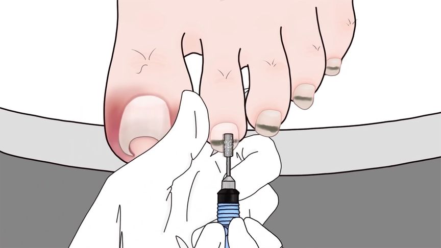 脚指甲护理动画