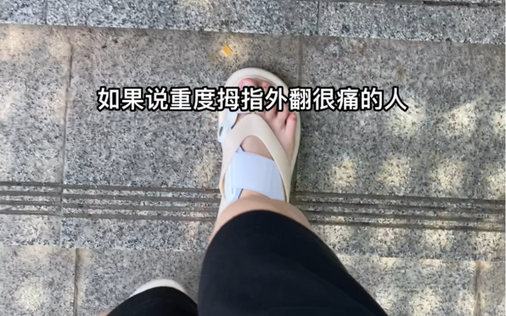 脚拇指外翻很痛,2个月前买矫正器来缓解,今天说说我的感受