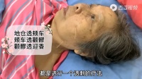 焦守廷上传、口眼歪斜长期难愈面三针《地仓透颊车穴、颊车穴透颧髎...