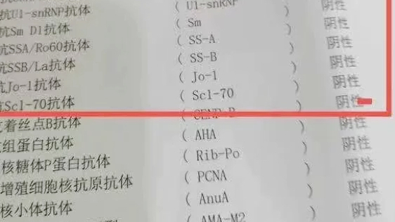 干燥综合症案例分析