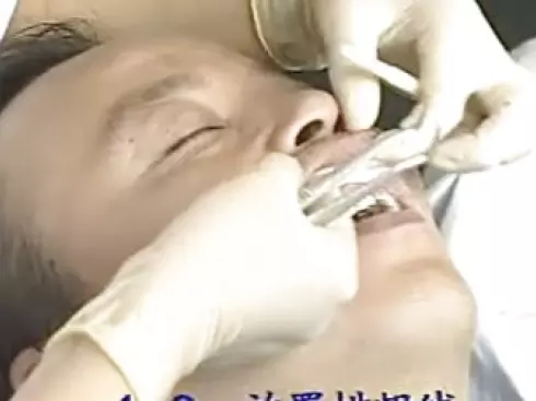 口腔医学视频-固定修复取模
