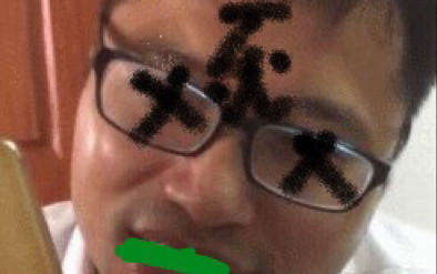 震惊!某UP主竟把无菌包打得出屎!