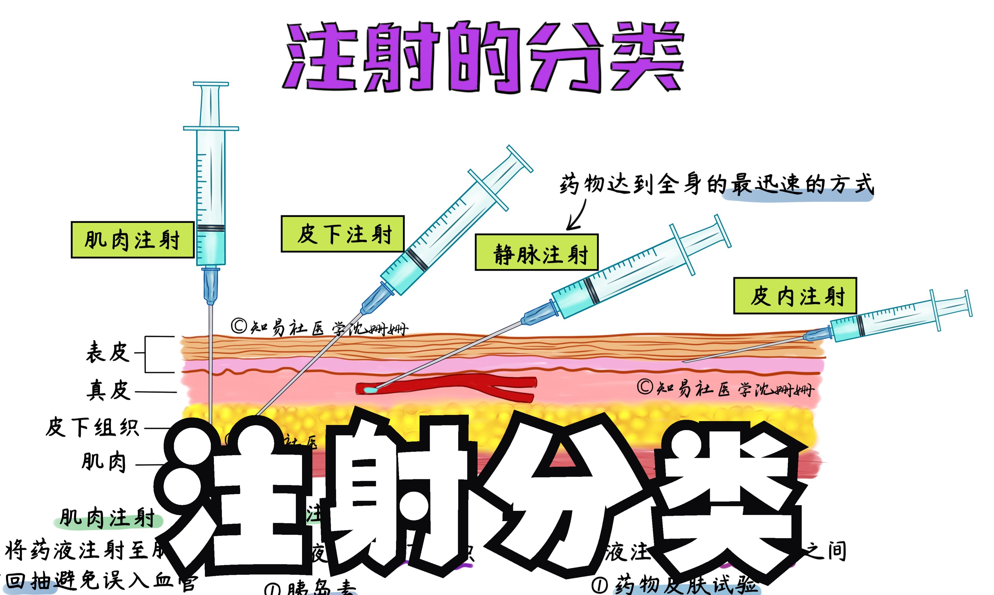 手绘笔记 注射分类 | 皮内注射 皮下注射 肌肉注射 静脉注射