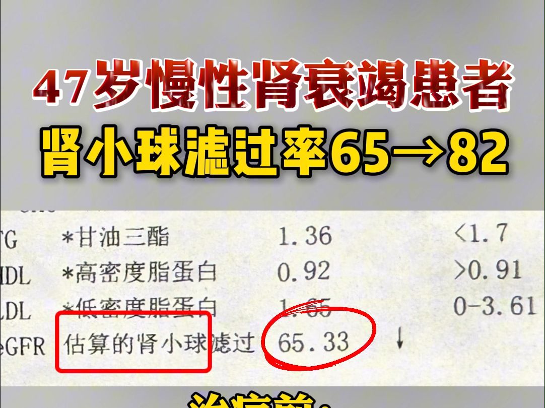 47岁慢性肾衰竭患者 肾小球滤过率65→82