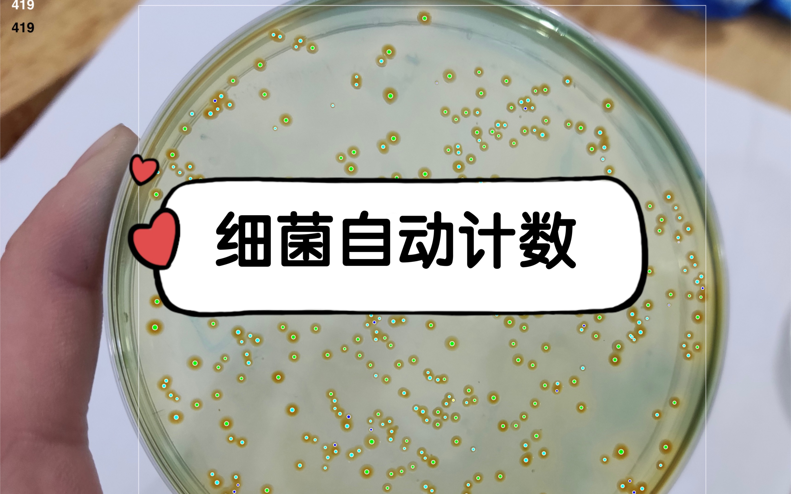 细菌菌落自动计数,你是手动计数还是自动计数呢?科研日常好帮手,工具...