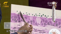 吸入的颗粒物如何排出?别担心,“它”是支气管的“清洁工”