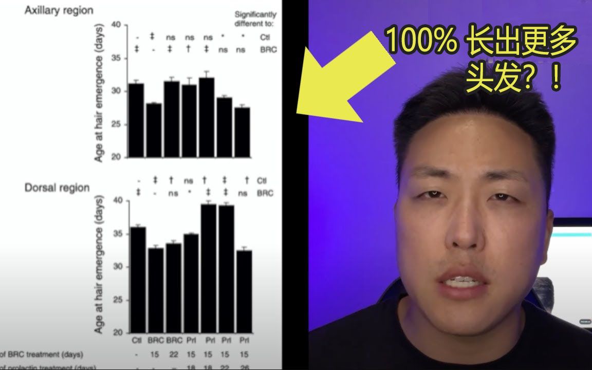 “脱发抗体”催乳素受体拮抗剂 HMI-115 |这能治愈脱发吗?