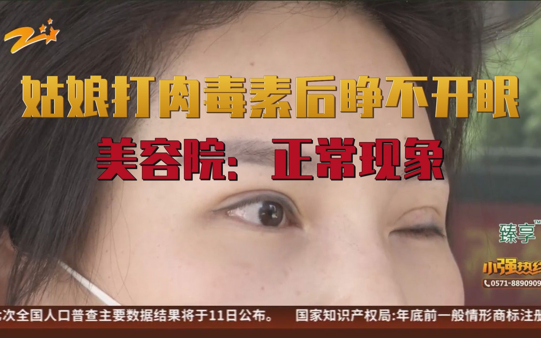 姑娘打肉毒素后眼睛睁不开 姑娘成“独眼” 美容院:正常现象