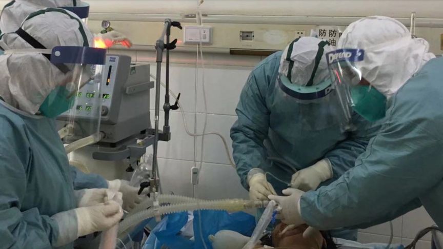 高危90秒!实拍医生抢救患者“气管插管”,全过程近距离口鼻相对