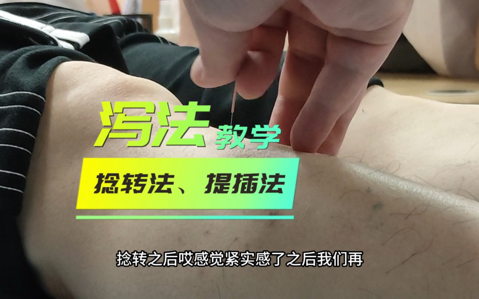 中医针灸进针泻法,规范操作,仅供参考,