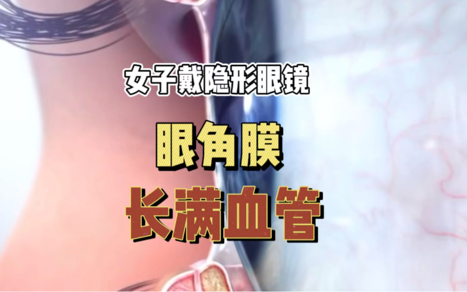 女子戴隐形眼镜10年,角膜长满新生血管