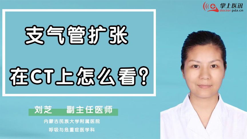 各类支气管扩张在CT上怎么看?结合病例,听听专家怎么说