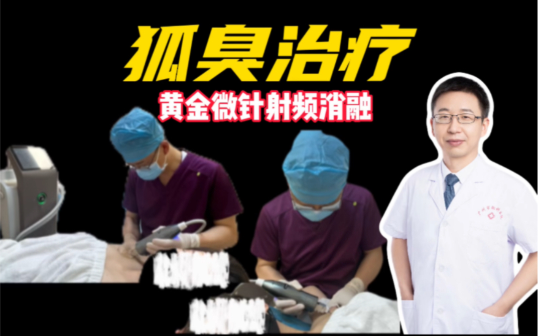 【已退出狐族】黄金微针射频消融治疗腋臭中···