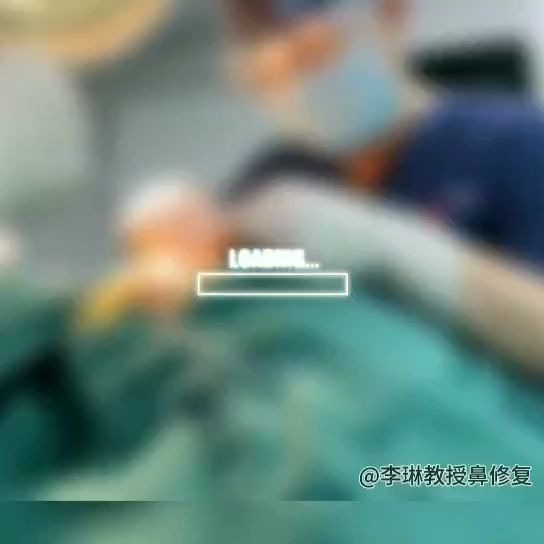 鼻整形术中,对鼻型、鼻梁和鼻头的观看确认有多重要?