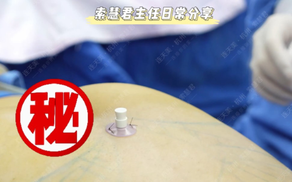 吸脂都会用的切口保护器,也有大学问