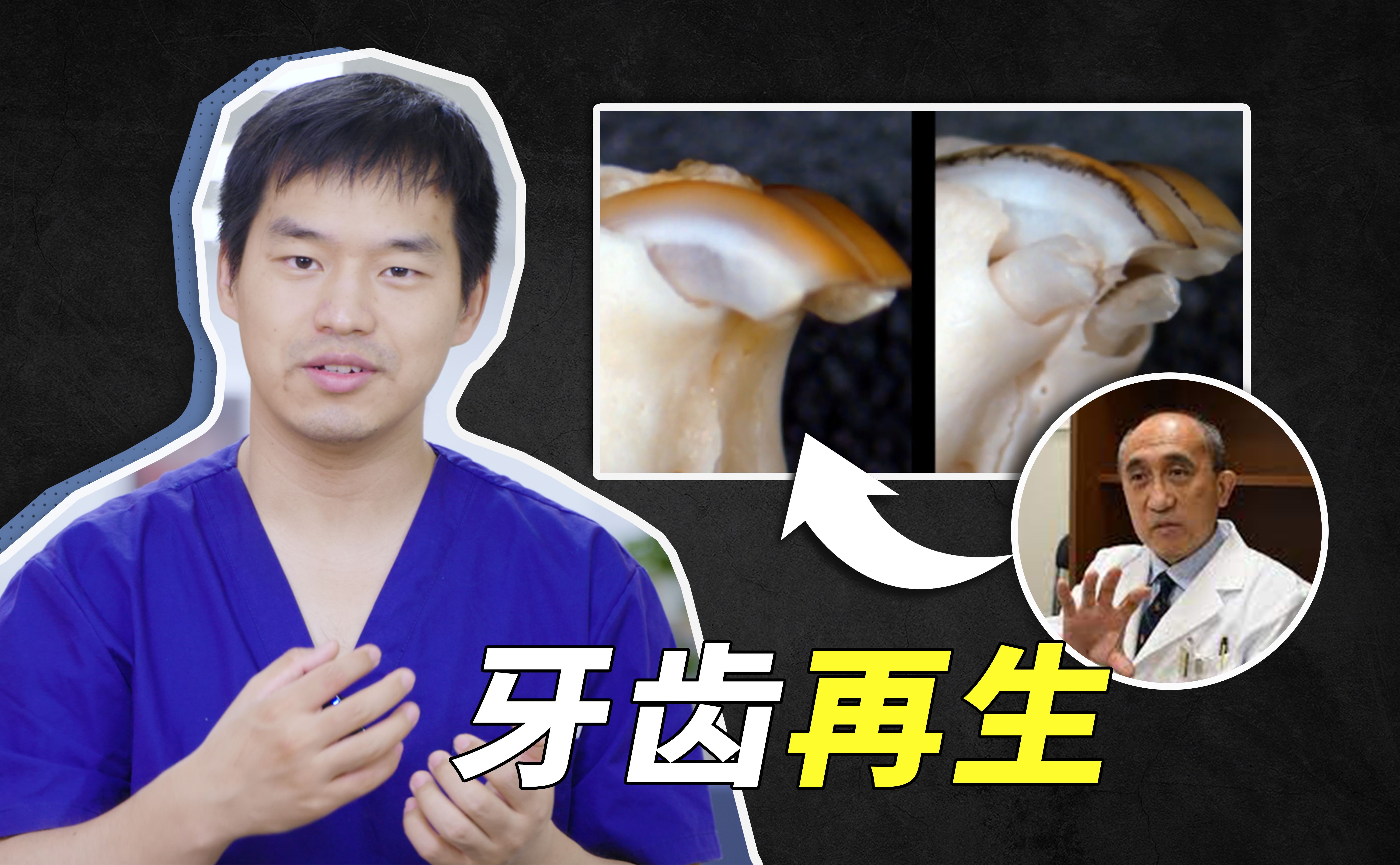 人类牙齿再生不是梦?让缺牙患者不再种植牙?