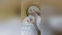 活检针 操作视频