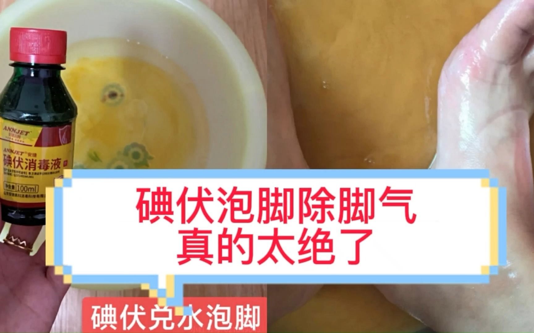 真好用,泡脚水里加碘伏去脚气真的绝了,脚痒脚臭全搞定