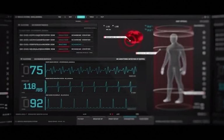 AE模板-科技感电影游戏医疗屏幕替换脑电波扫描动画心率_心跳监测...