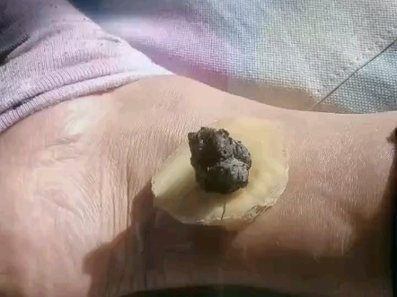 倪海厦老师讲解艾灸复溜穴好处