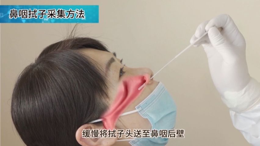 核酸标本采集#鼻咽拭子的正确采集方法。
