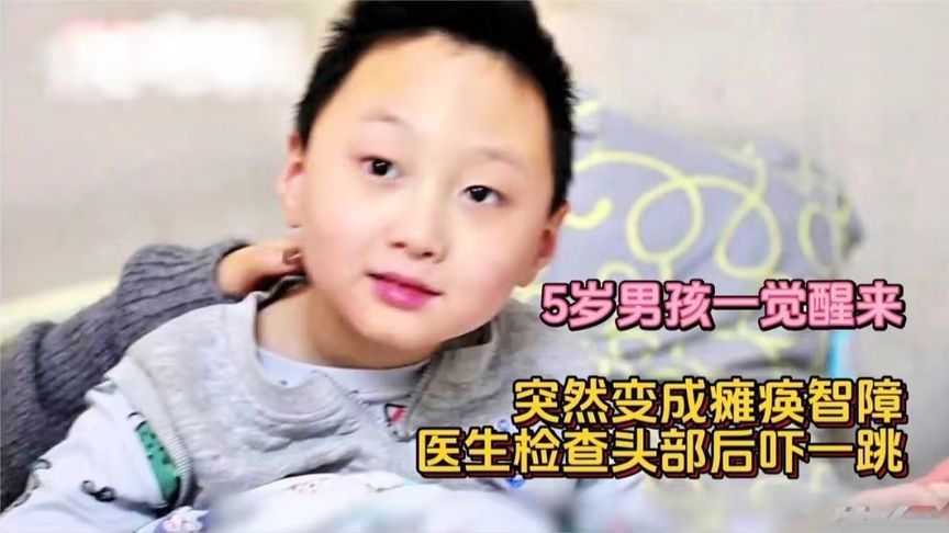 突然变成瘫痪智障,医生检查头部后吓一跳