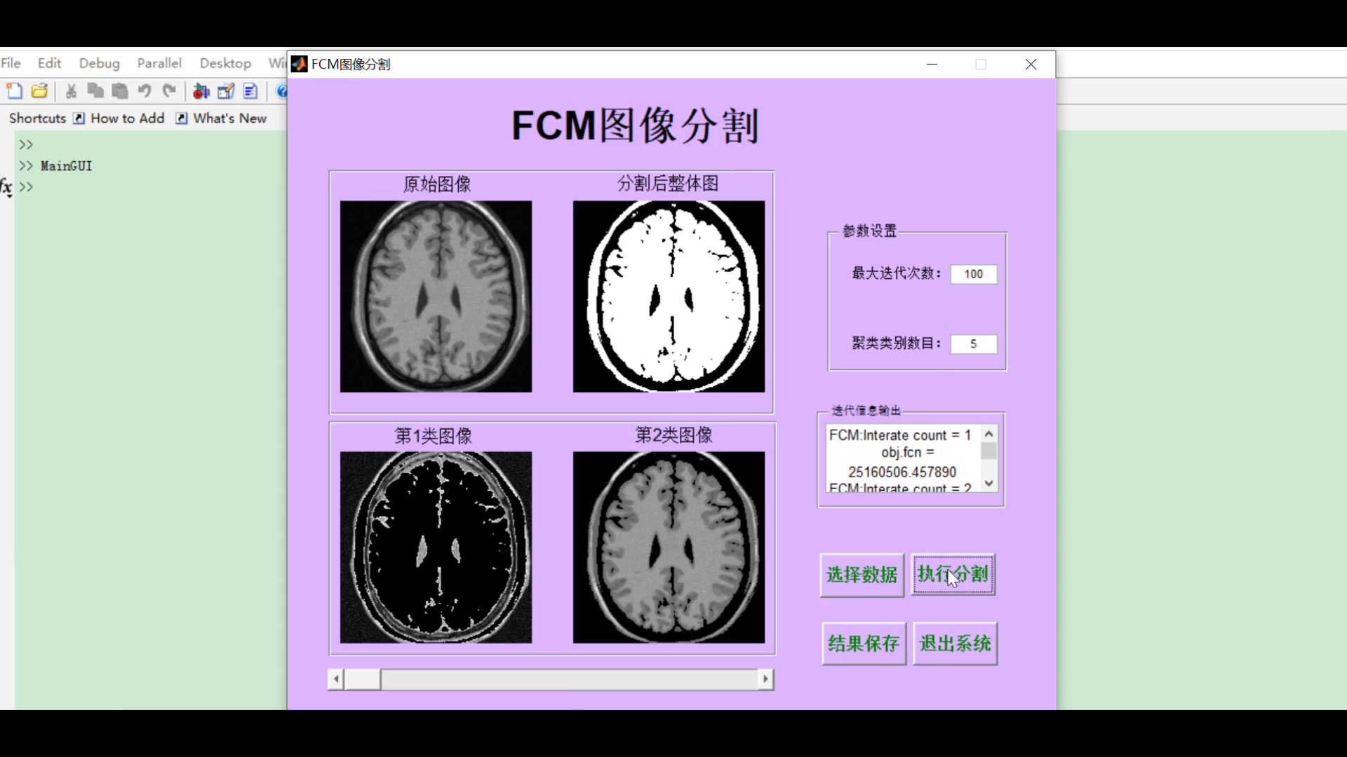 MATLAB图像分割系统+FCM算法【非中介】