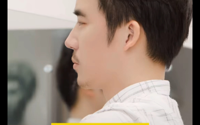 说三庭五眼标准但是还是不影响丑的,看看什么原因!