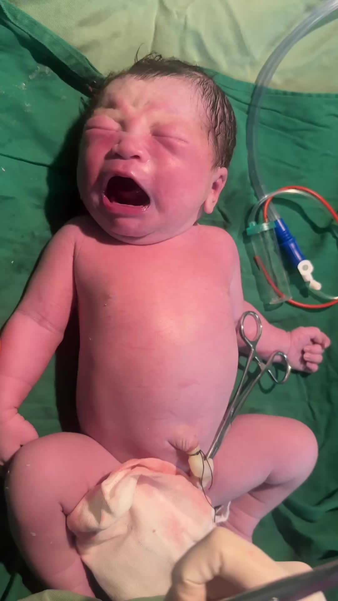 脐带 剪掉这个小尾巴,你就是个独立体了喔。#脐带#刚出生的宝宝