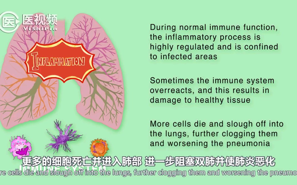 新型冠状病毒感染人体后,对人体产生哪些影响