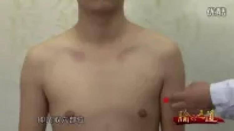 心脏保健之法~天泉穴(穴位按摩)