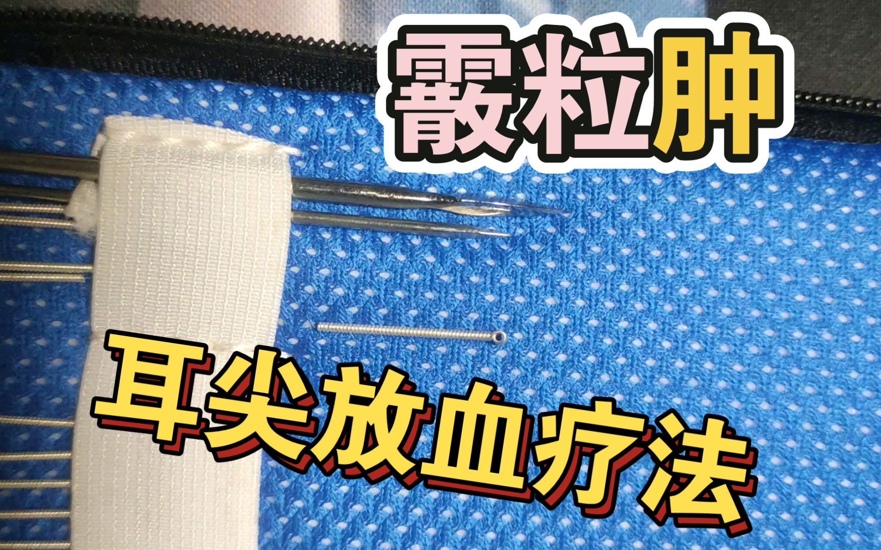 三棱针耳尖放血疗法——治霰粒肿