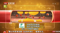 血管“抽筋”没有斑块破裂,也可能导致猝死,究竟是怎么回事?