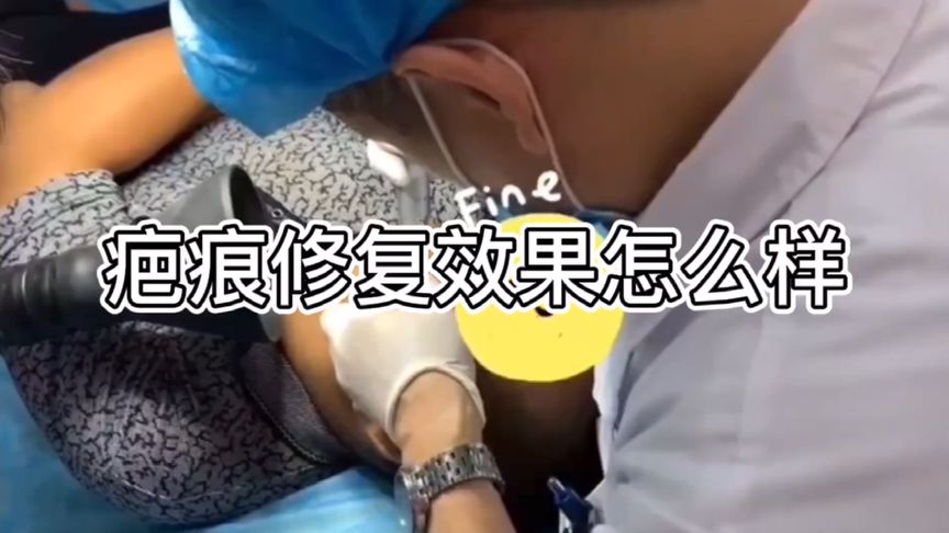 疤痕修复效果怎么样,疤痕是否可以消除?