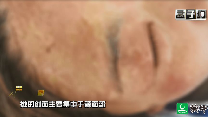 管道疏通剂可不能乱用,不然很受伤!