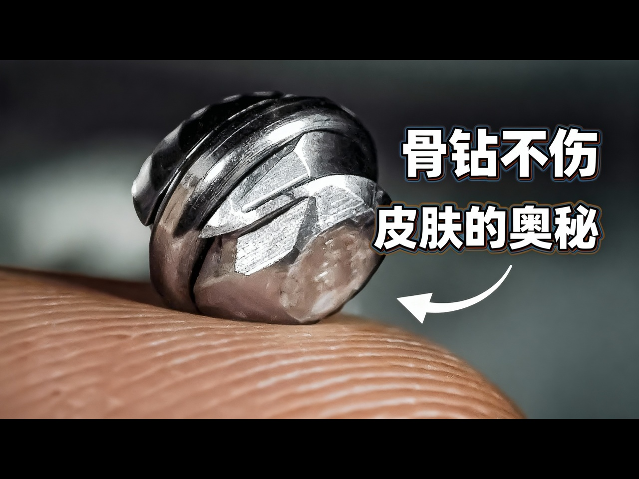 【中配】骨钻在人皮肤上的奇妙表现:为何它能钻骨却不伤肤 - Steve ...