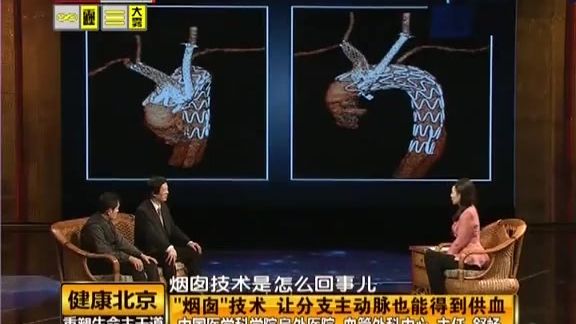 治疗主动脉夹层的“烟囱技术”,让分支动脉也能得到供血