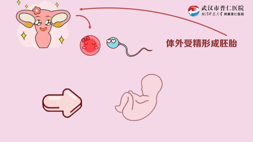 一分钟小百科丨什么是“试管婴儿”?