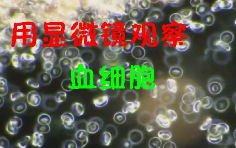 UP主用显微镜观察自己的血细胞
